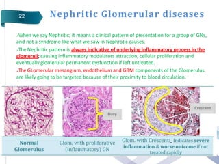 Glomerular Diseases.pptx