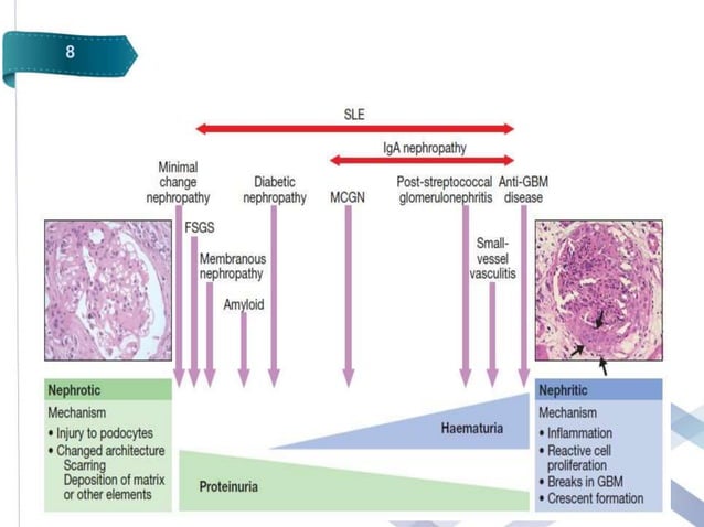 Glomerular Diseases.pptx
