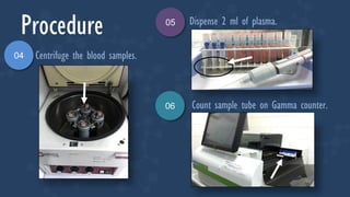 Nuclear Medicine - GFR - Case Study - Procedure | PDF