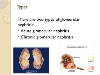 GLOMERULAR NEPHRITIS+URETHRAL STRICTURE+HYDRONEPHROSIS+HYDROURETER.pptx