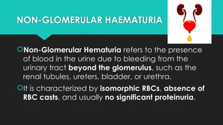 Glomerular vs Non-Glomerular Haematuria by Shahil Ahmed.pptx