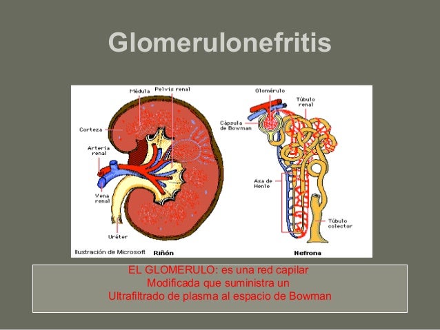 Fisiopatologia Da Glomerulonefrite