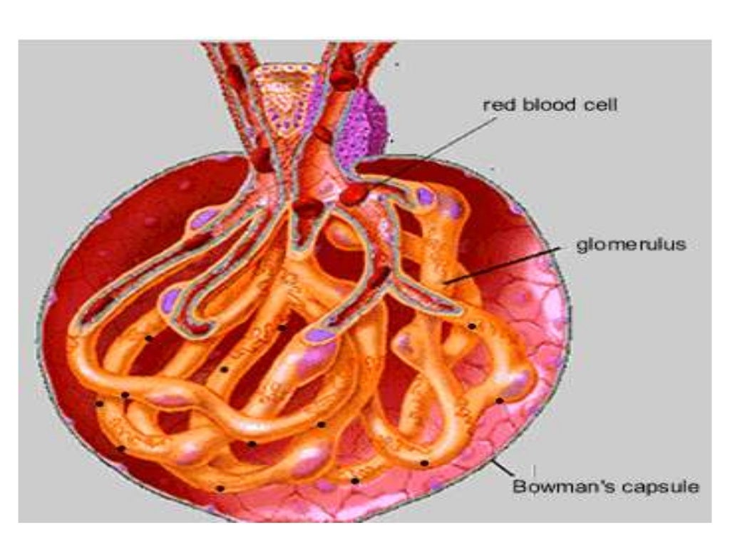 Glomerulonephritis =)