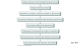 Glomerulonephritis Pathophysiology