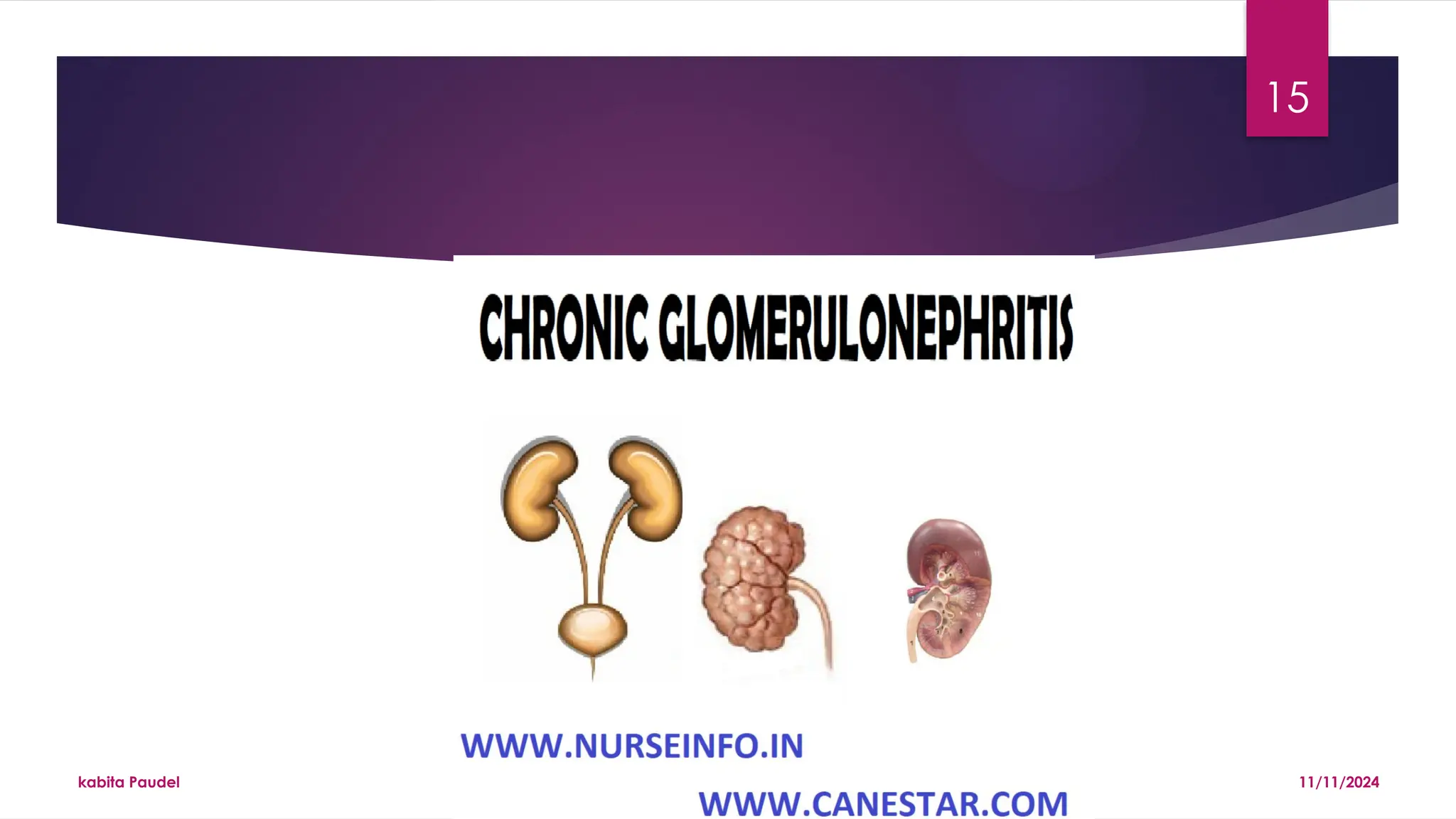 Glomerulonephritis in Pediatric Population .pptx | Infectious Diseases | Diseases and Conditions