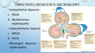Glomerulonephritis at a glance | PPTX