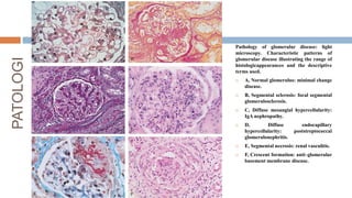 Glomerulonephritis aldo | PPTX
