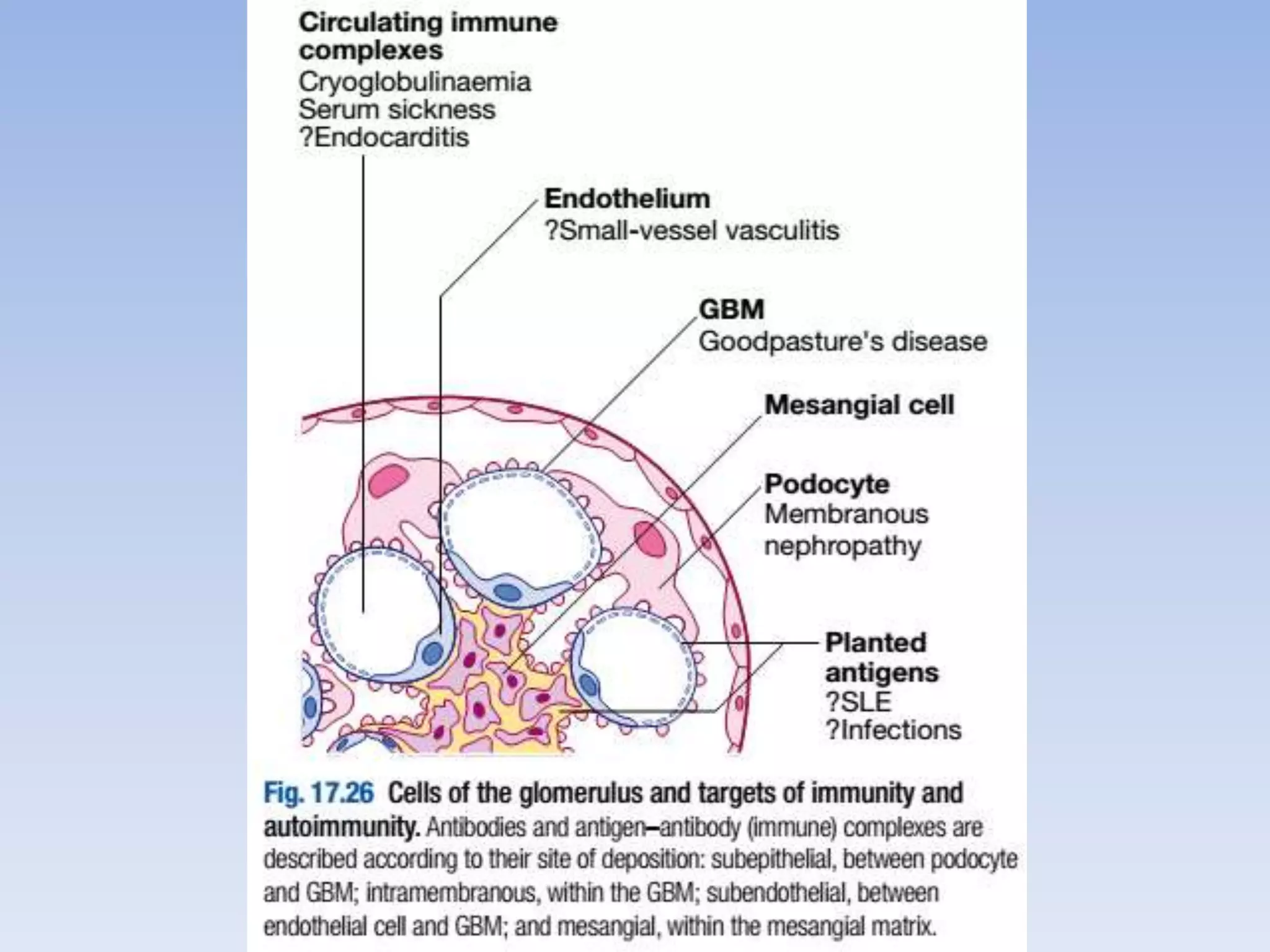 Glomerulonephritis and nephrotic syndrome | PPTX
