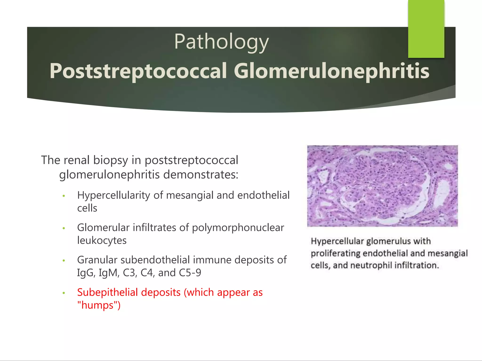 Acute Glomerulonephritis | PPTX