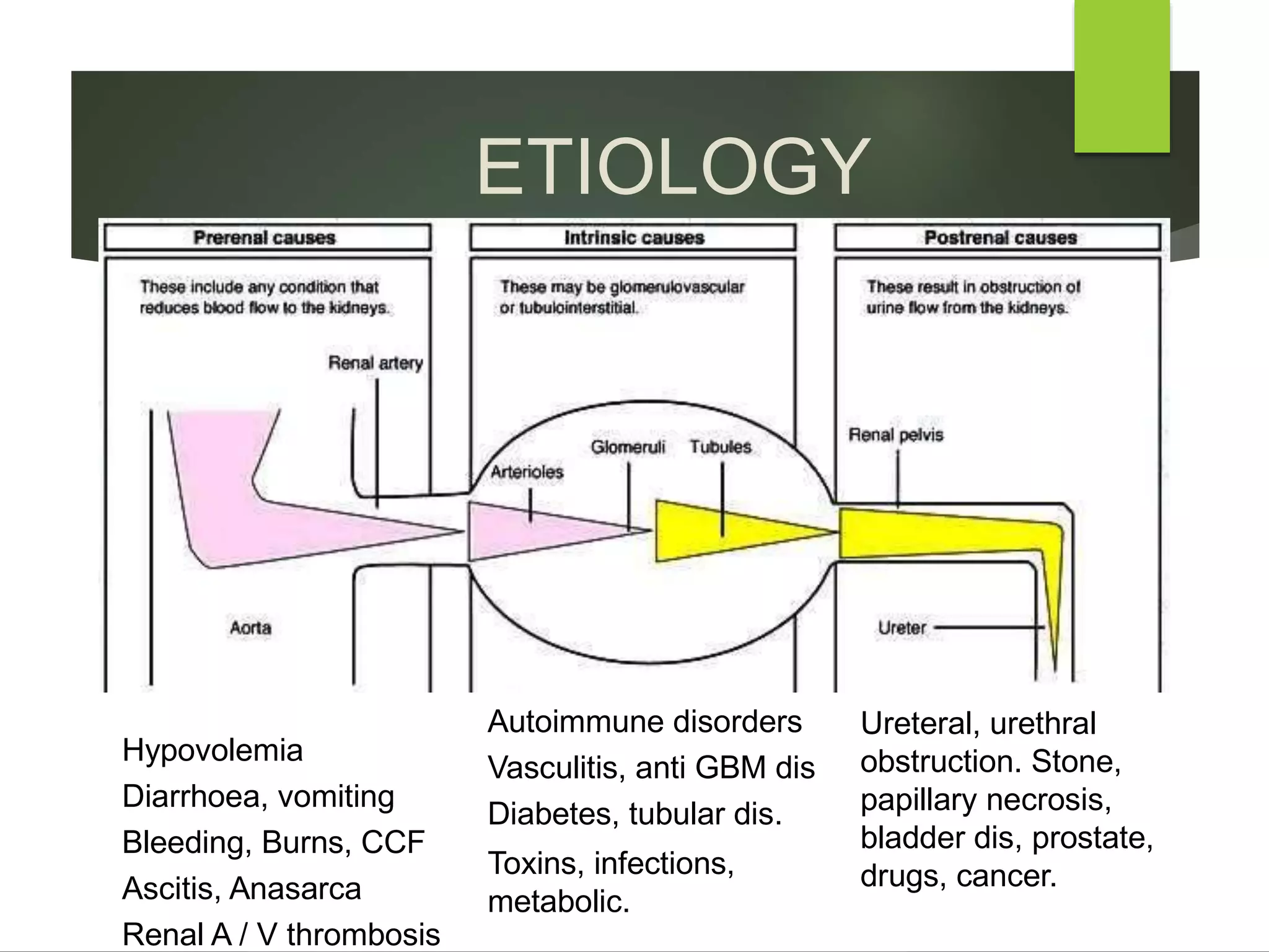 Acute Glomerulonephritis | PPTX