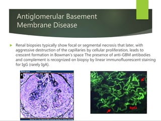 Acute Glomerulonephritis | PPTX