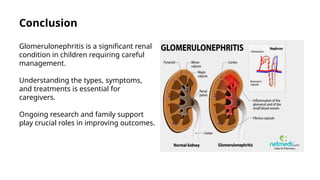 Glomerulonephritis In Children 2.pptx mbbs | PPTX