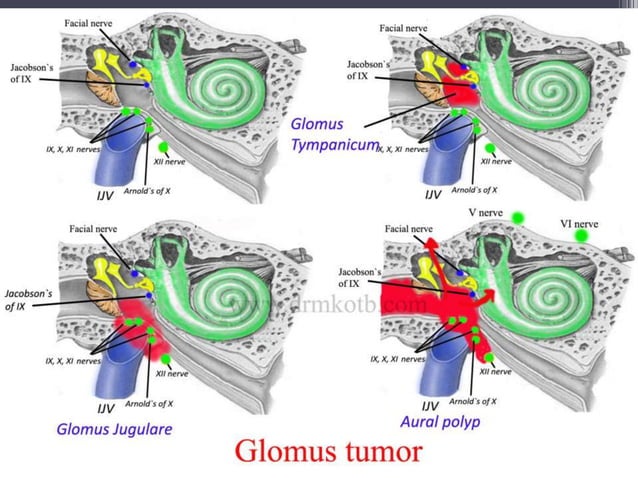 Glomus anatomy n intro | PPTX
