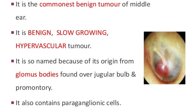 Glomus Tumour