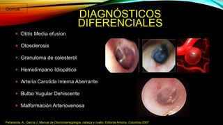 Glomus yugulotimpanico | PPT