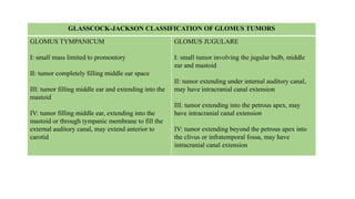 GLOMUS TUMOR.pptx