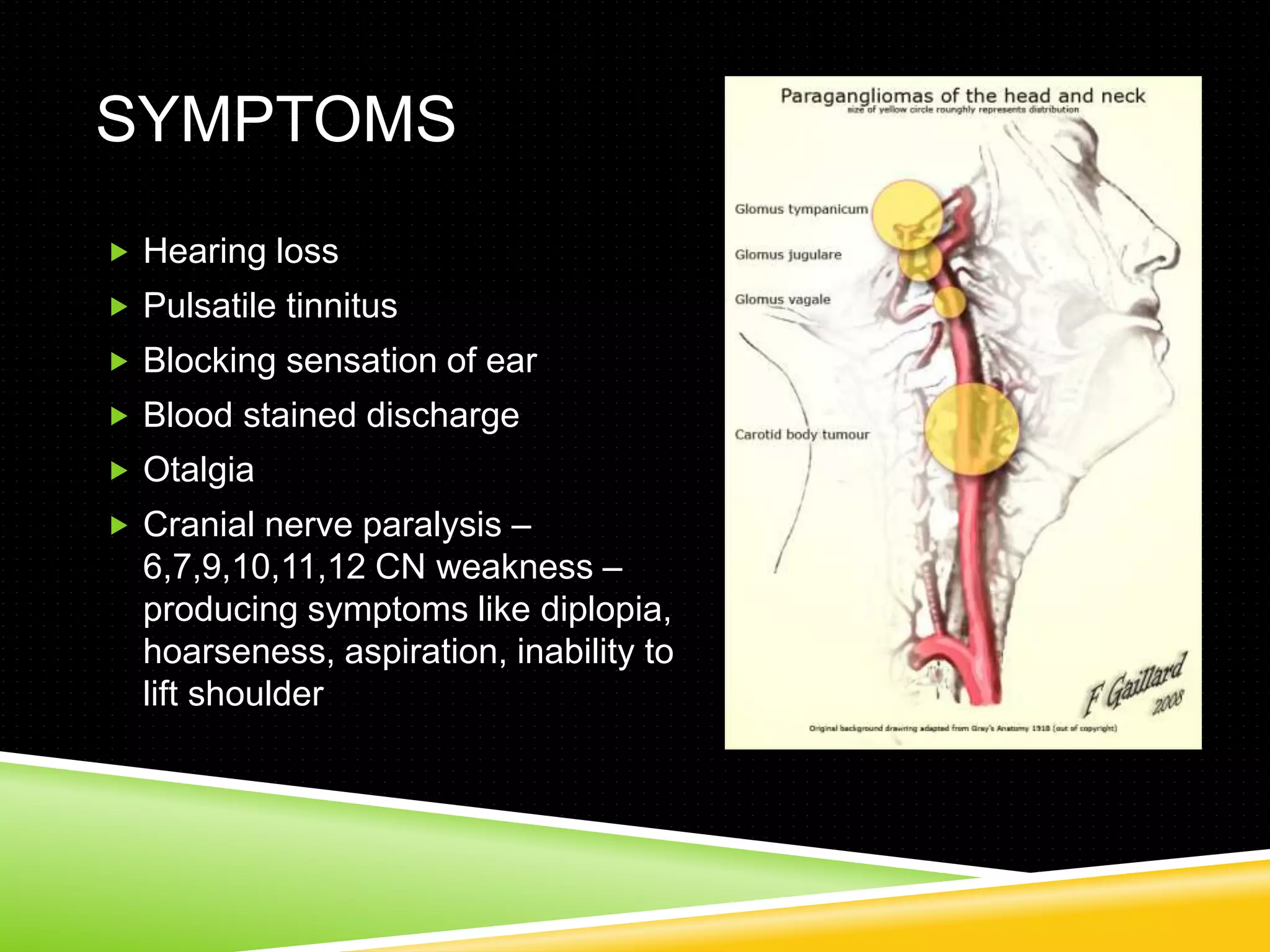 Glomus tumors | PPTX