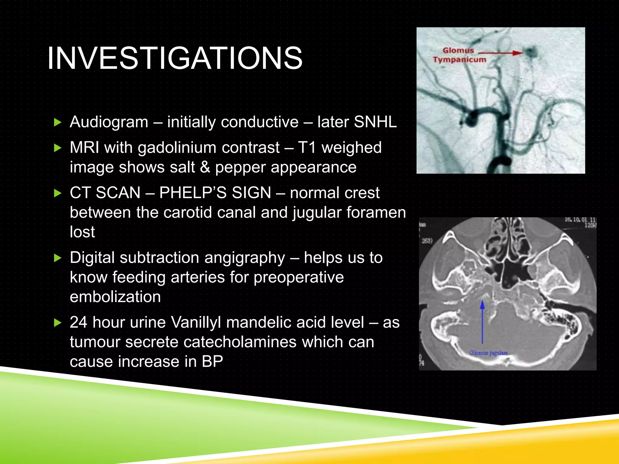 Glomus tumors | PPTX