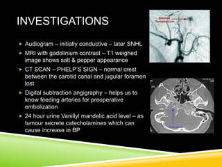 Glomus tumors | PPTX