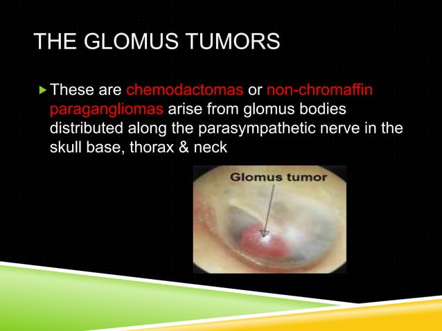 Glomus Tumors