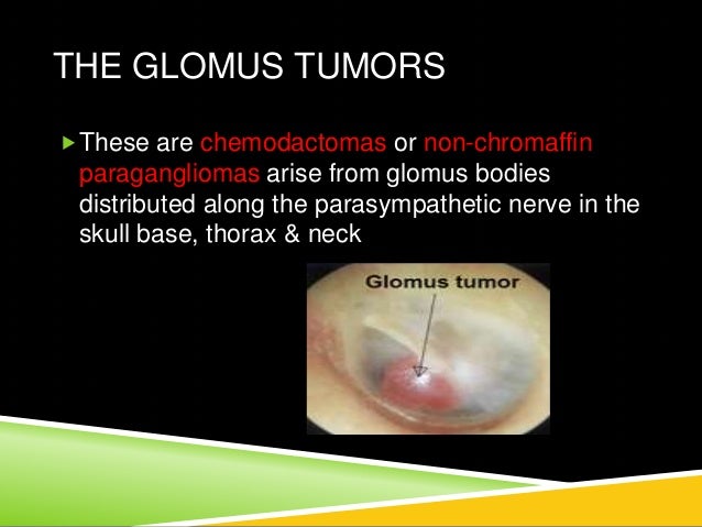 Glomus tumors
