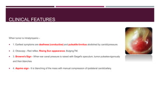 Glomus tumour | PPTX