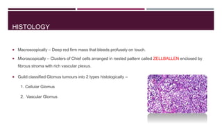 Glomus tumour | PPTX