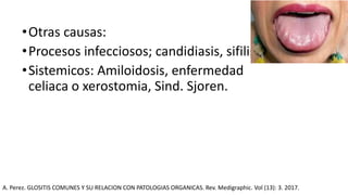Glositis | PPTX