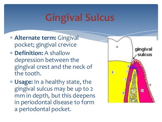 Gingival Sulcus