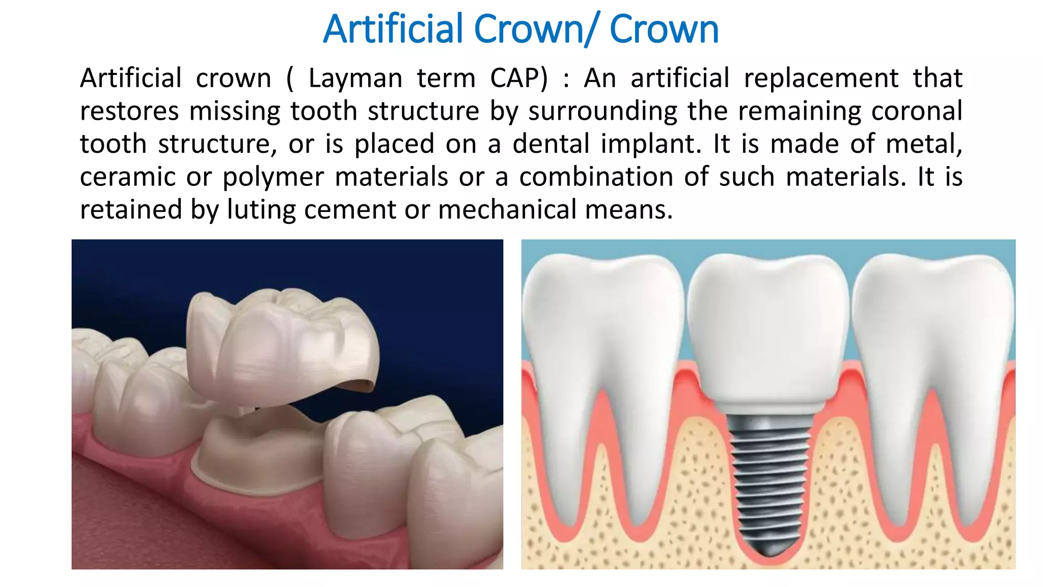 Glossary of Dental Terminology.pptx