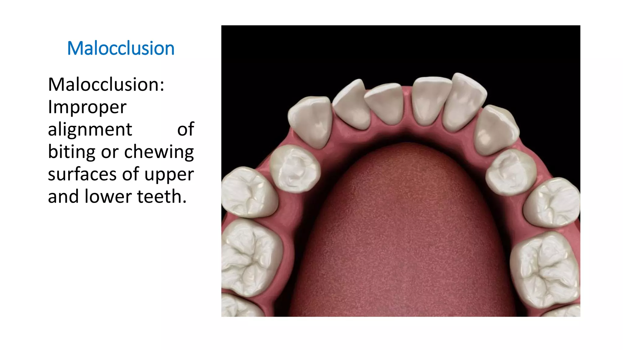 Glossary of Dental Terminology.pptx