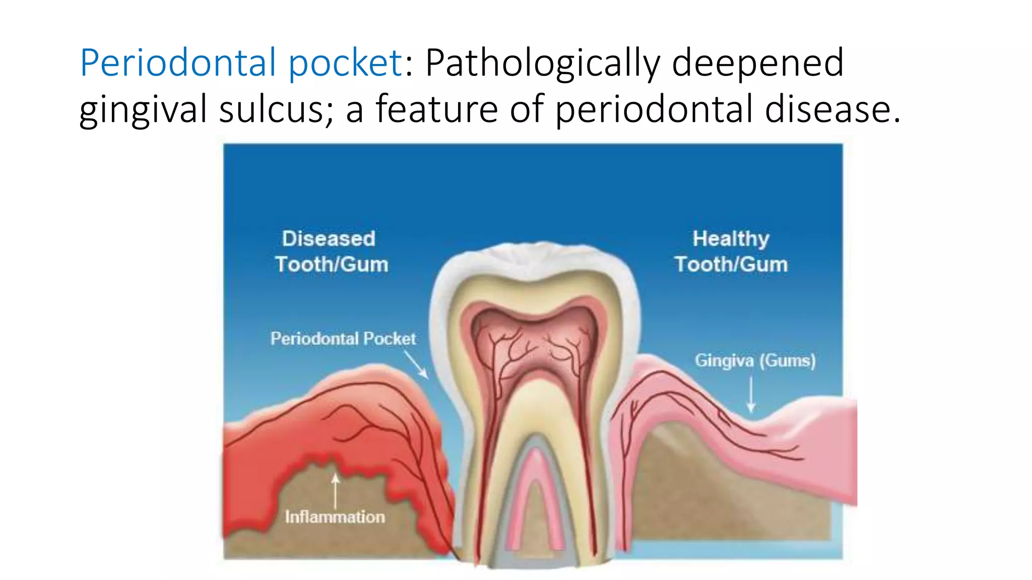 Glossary of Dental Terminology.pptx