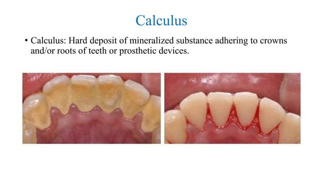 Glossary of Dental Terminology.pptx