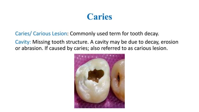 Glossary of Dental Terminology.pptx