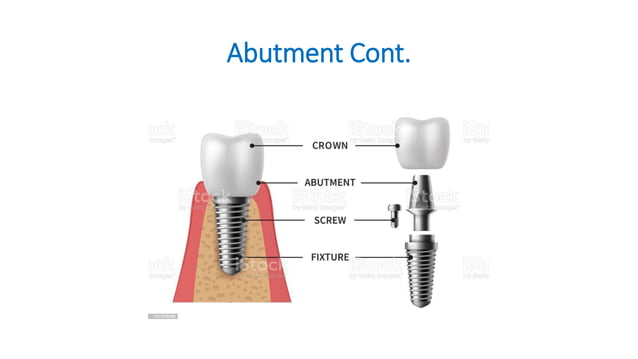 Glossary of Dental Terminology.pptx