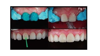 Glossary of Dental Terminology.pptx