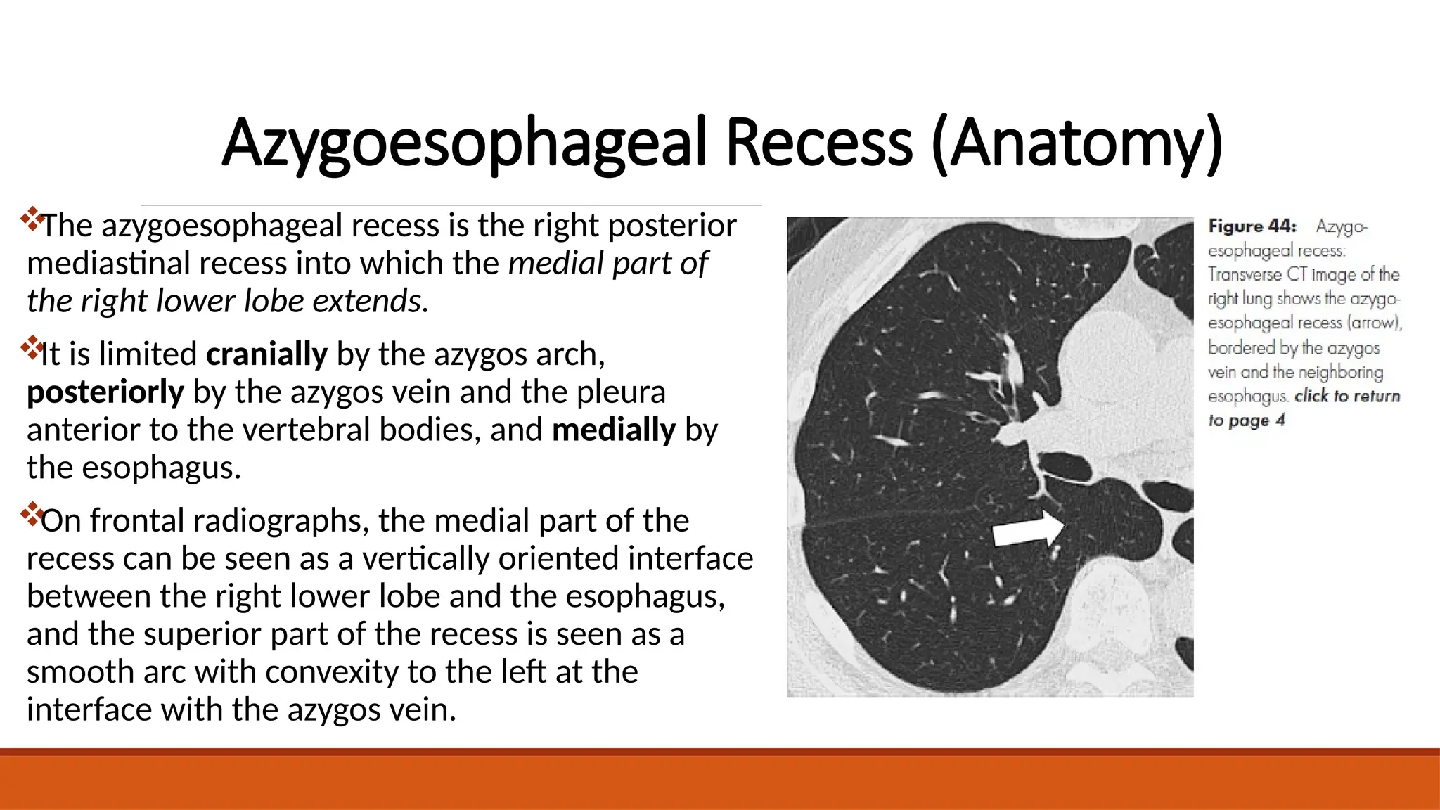 Glossary of terms in Thoracic Radiology: The Fleischner Society 2024 ...