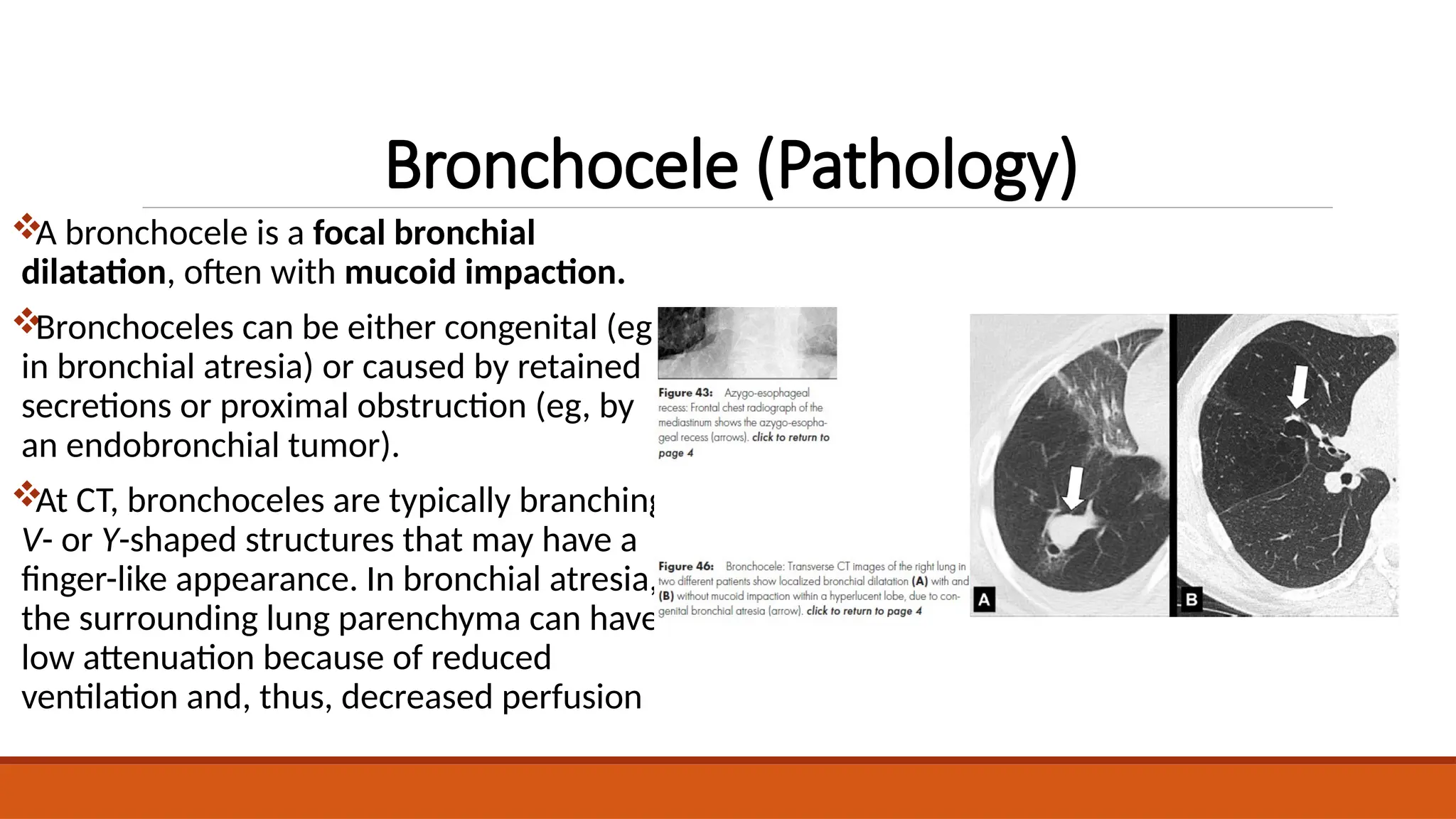 Glossary of terms in Thoracic Radiology: The Fleischner Society 2024 ...