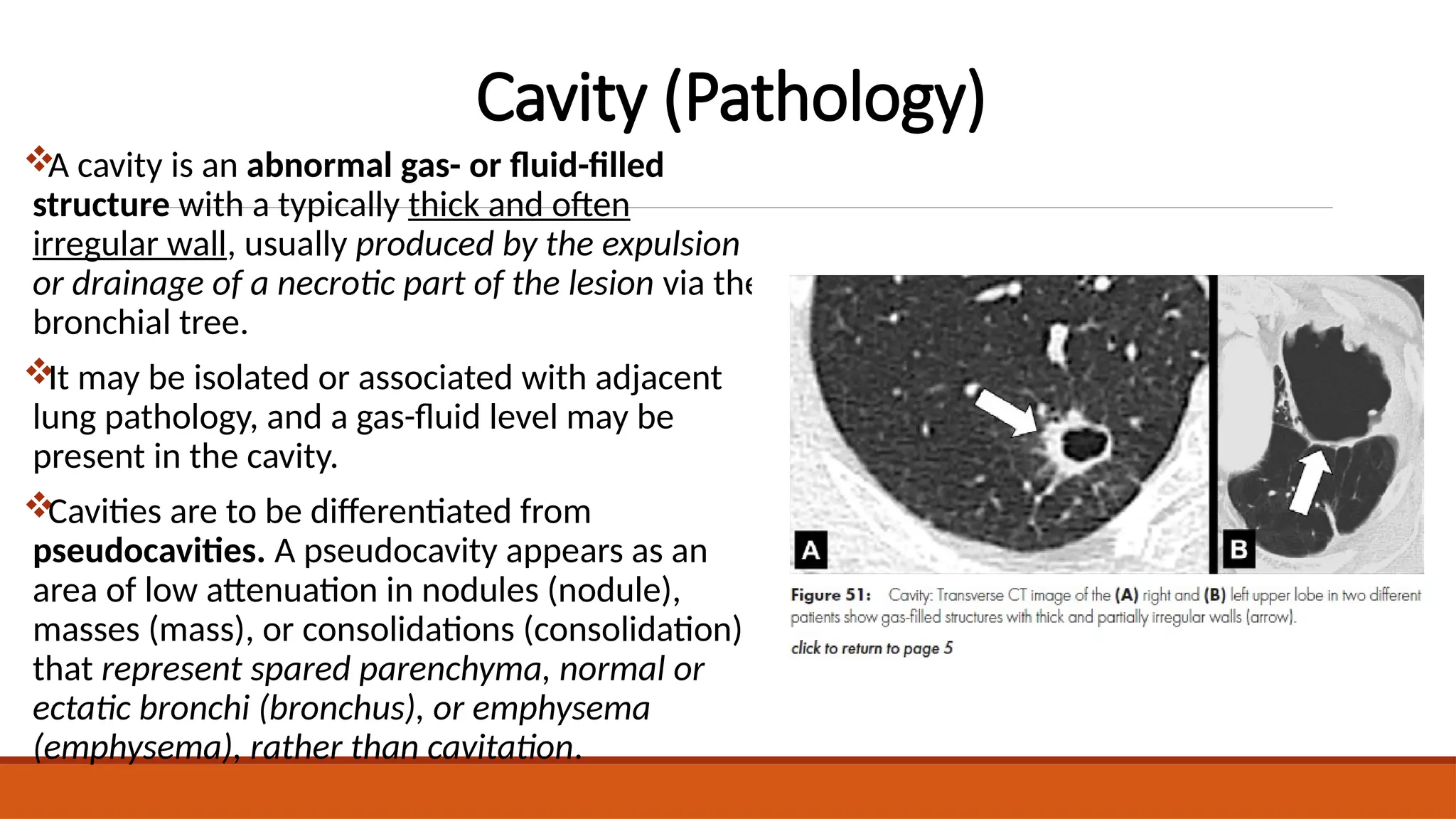 Glossary of terms in Thoracic Radiology: The Fleischner Society 2024 ...
