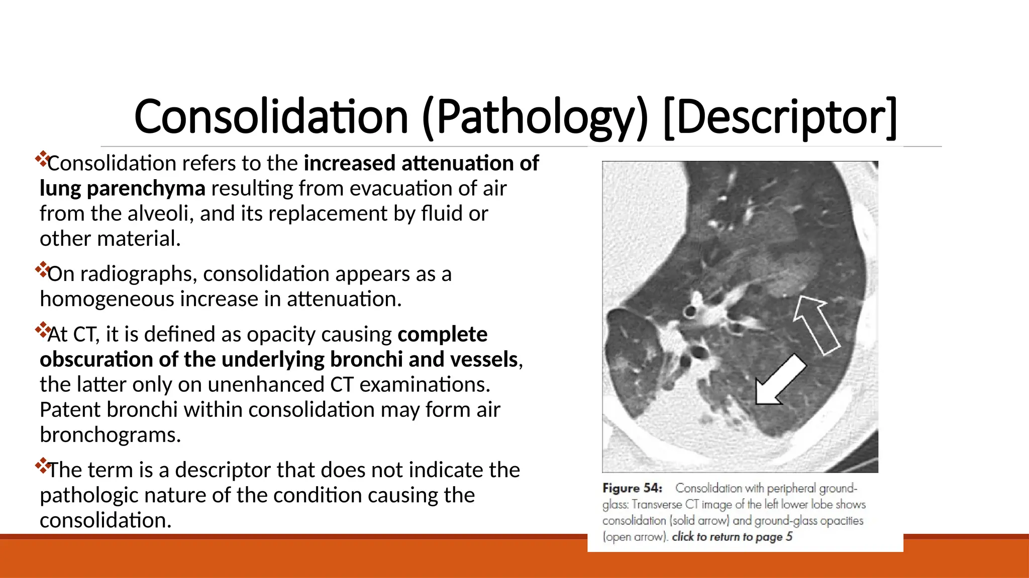 Glossary of terms in Thoracic Radiology: The Fleischner Society 2024 ...