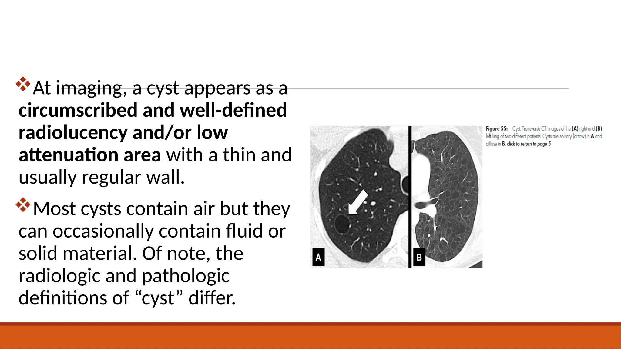 Glossary of terms in Thoracic Radiology: The Fleischner Society 2024 ...