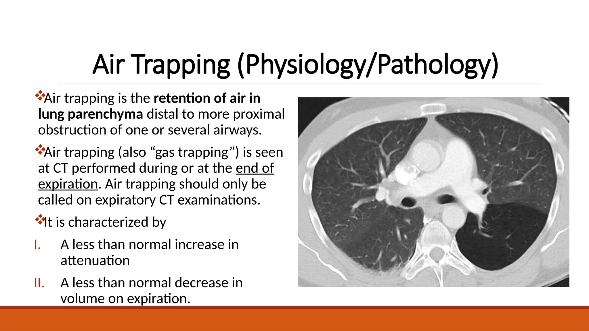Glossary of terms in Thoracic Radiology: The Fleischner Society 2024 ...