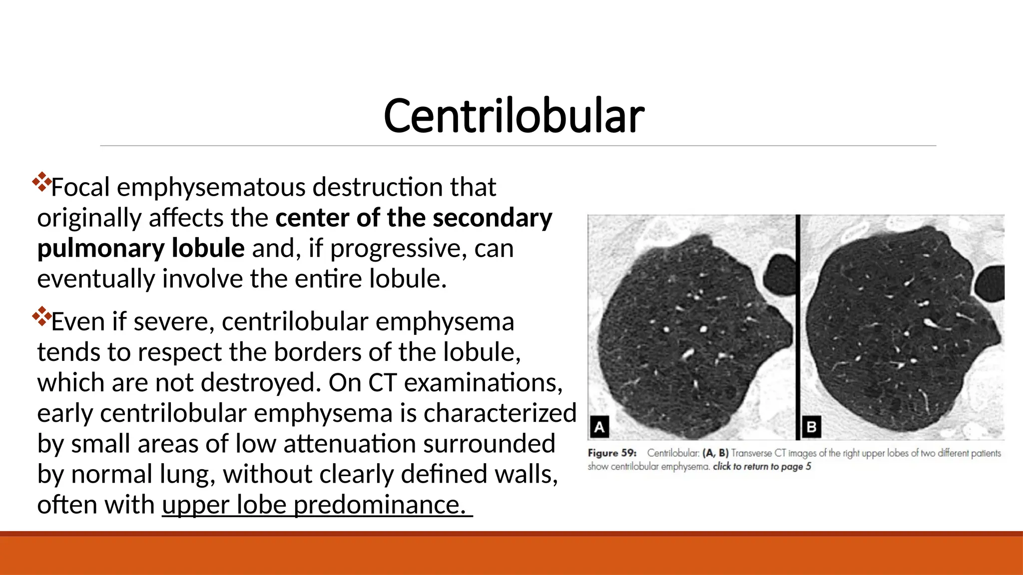 Glossary of terms in Thoracic Radiology: The Fleischner Society 2024 ...