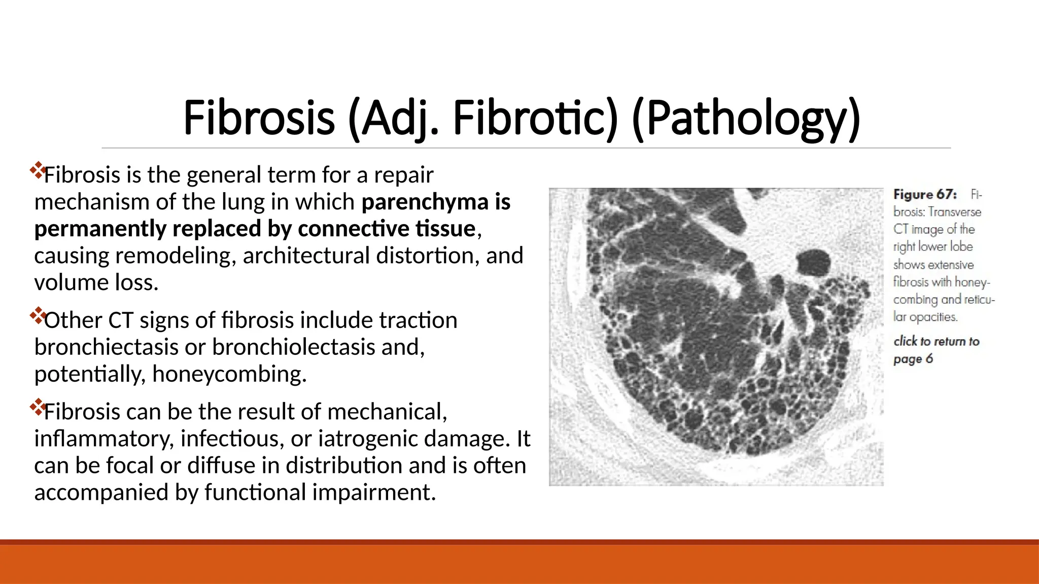 Glossary of terms in Thoracic Radiology: The Fleischner Society 2024 ...