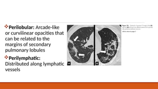 Glossary of terms in Thoracic Radiology: The Fleischner Society 2024 ...