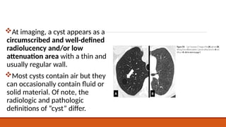 Glossary of terms in Thoracic Radiology: The Fleischner Society 2024 ...