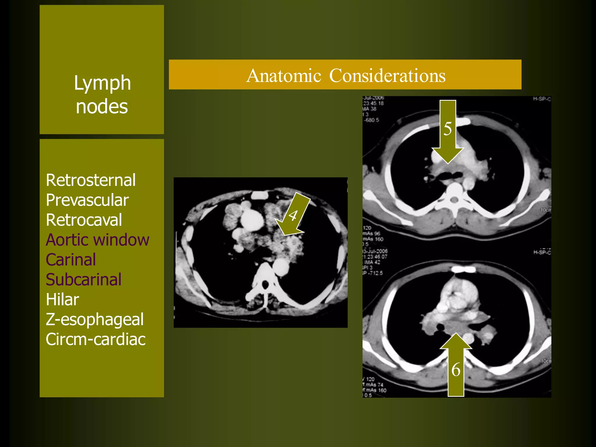 Glossary of thoracic imaging terms part 1 | PDF | Lung and Respiratory ...