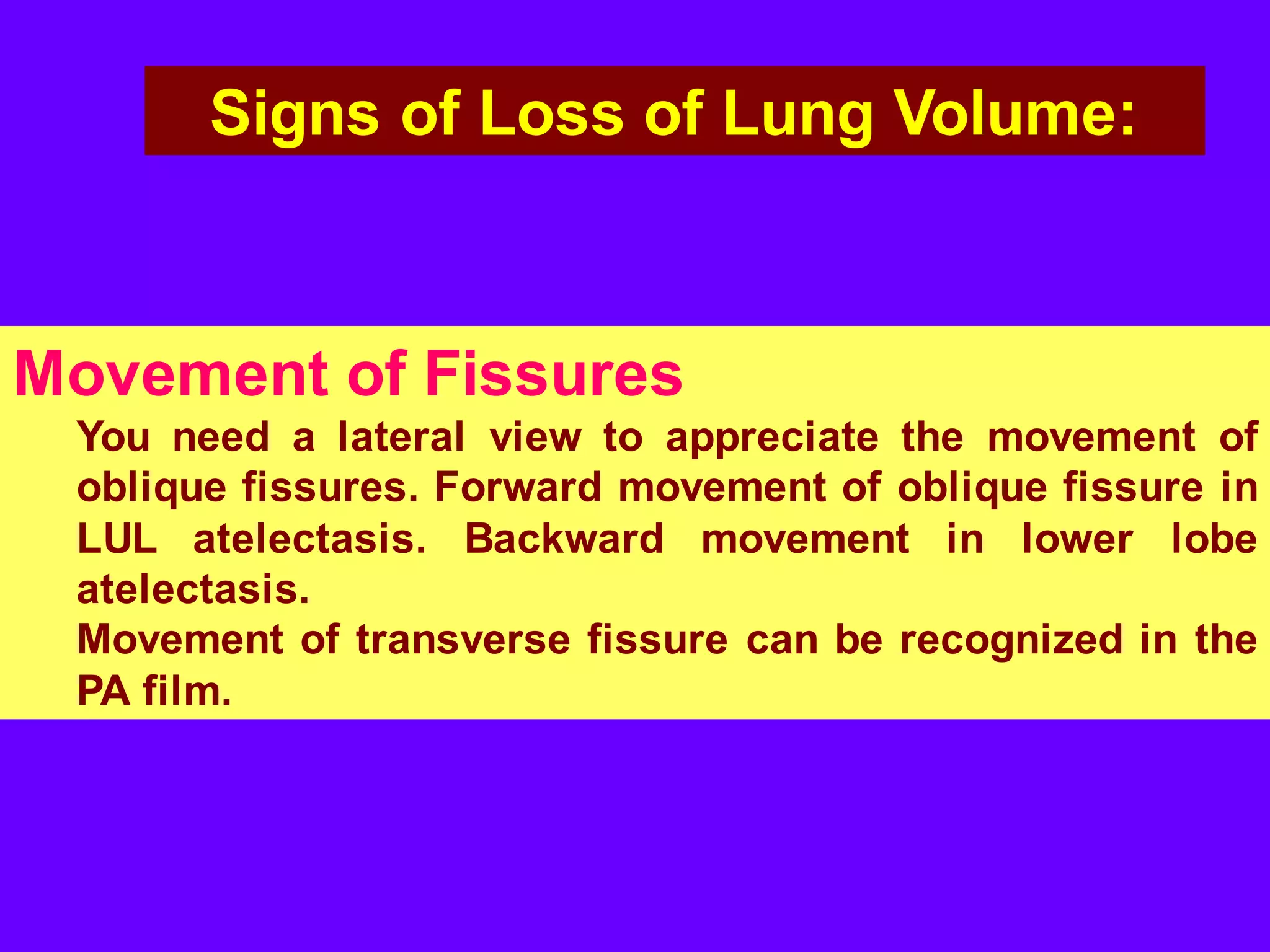 Glossary of thoracic imaging terms part 1 | PDF