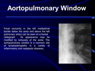 Glossary of thoracic imaging terms part 1 | PDF