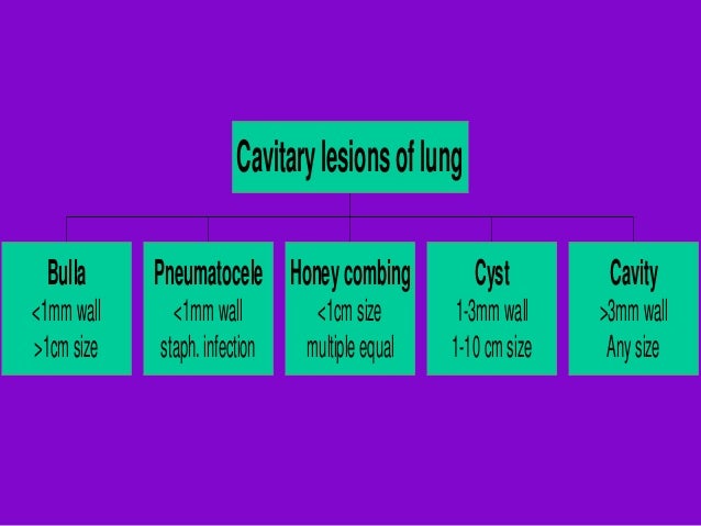 Glossary of thoracic imaging terms part 1